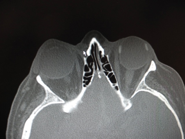 Photobook – North Carolina Retina Club